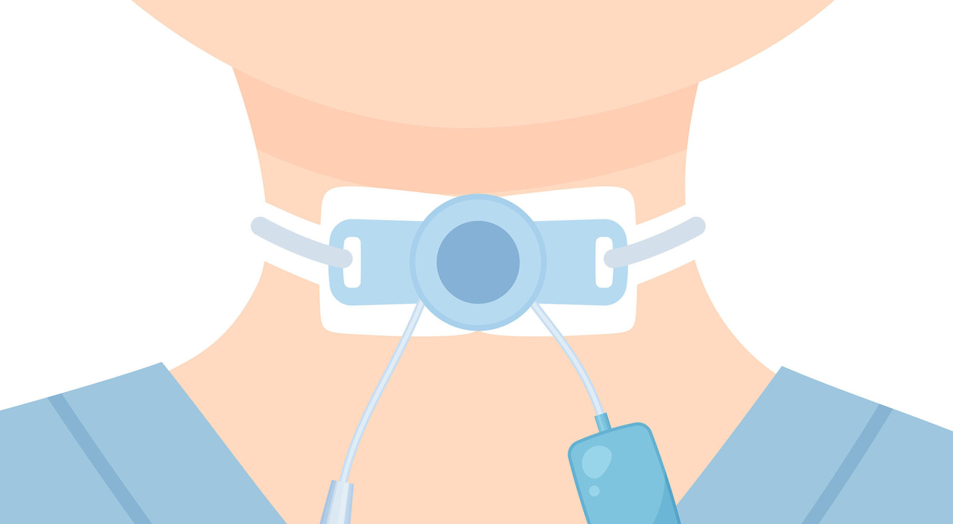 Trachealkanülenmanagement | Logopädie nach Luftröhrenschnitt